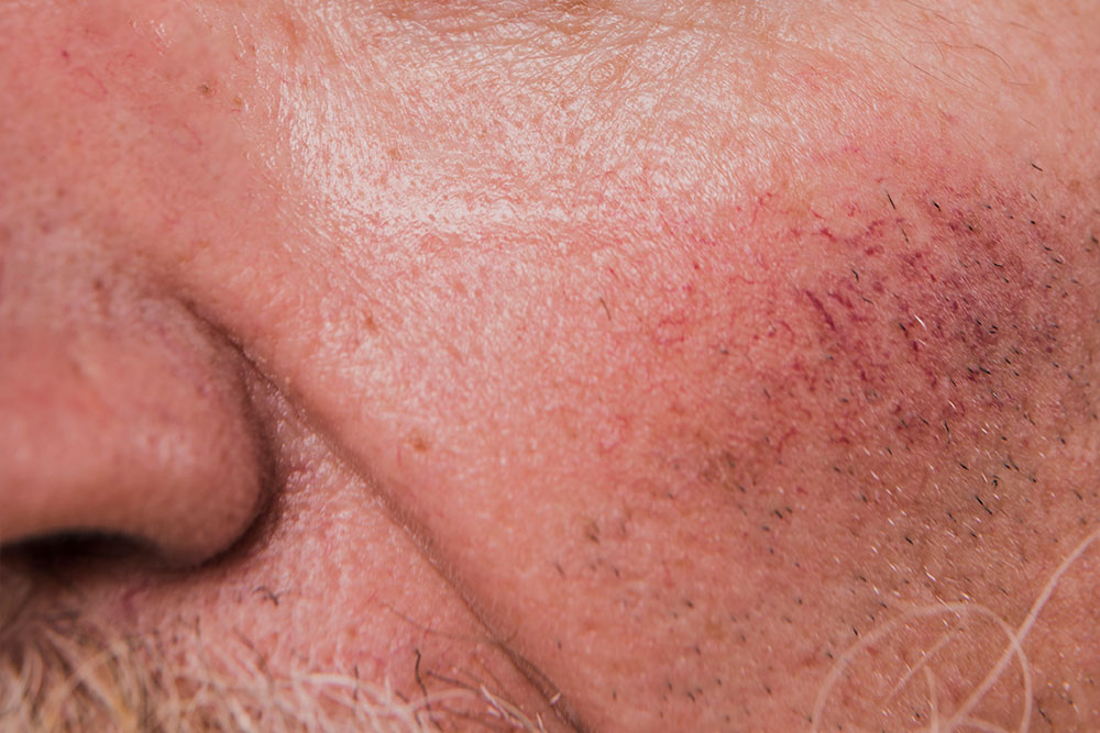 Fight Free Radical Damage: Protect Your Skin Naturally From Sun ...